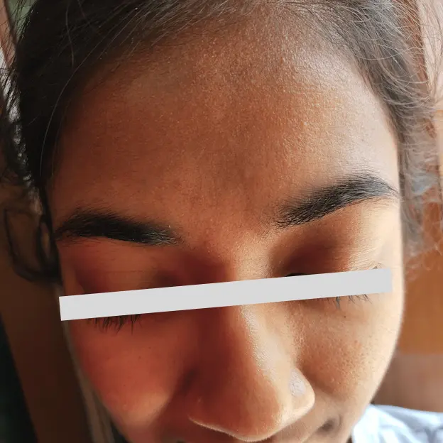 Best Hair Loss Treatment, Lab Test at Home | DermaQ