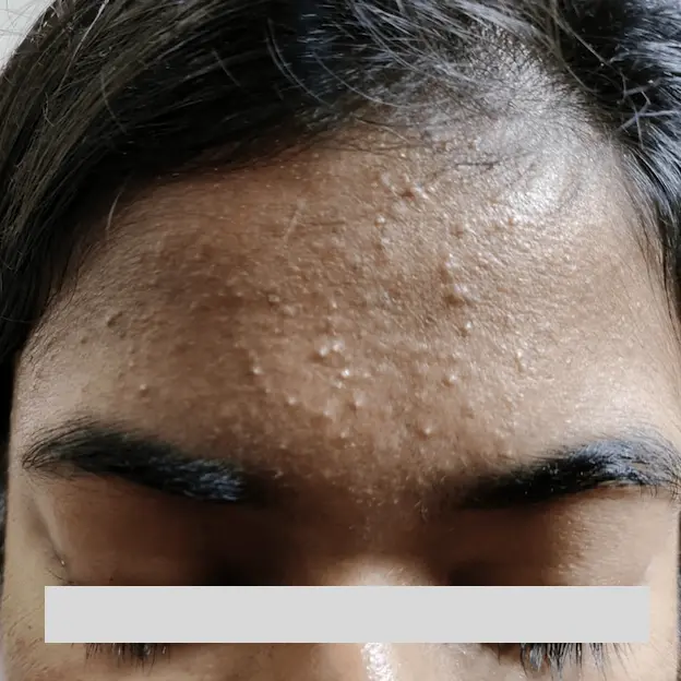 Best Hair Loss Treatment, Lab Test at Home | DermaQ